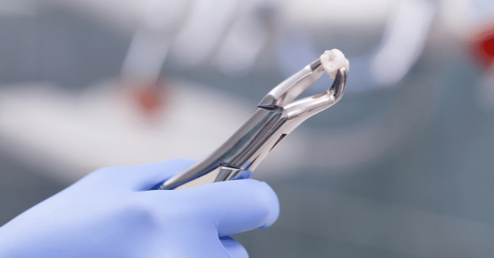 Tooth Extraction Complications: Risks After Dental Extractions - Share ...