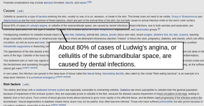 Dental Abscess: Symptoms, Causes, & Treatment - Share Dental Care