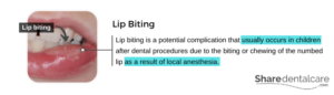 Tooth Extraction Aftercare (Instructions): The Dos & Don’ts