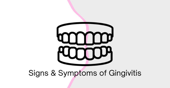 Signs & Symptoms of Gingivitis You Shouldn't Ignore - Share Dental Care