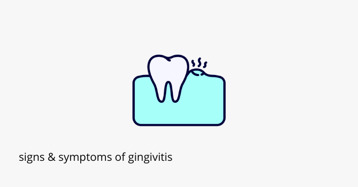 Symptoms of Gingivitis: Gum Disease Signs You Shouldn’t Ignore - Share ...
