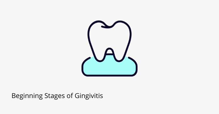 Early Stages of Gingivitis: Signs & Sympoms of Early Gum Disease ...
