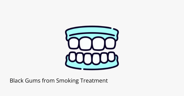 Black Gums from Smoking Treatment Options - Share Dental Care