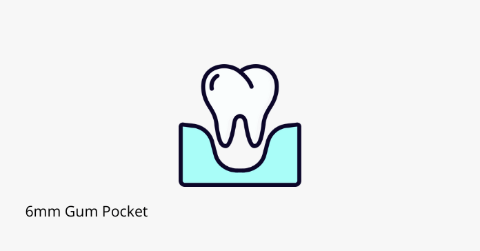 6mm Gum Pocket - Share Dental Care