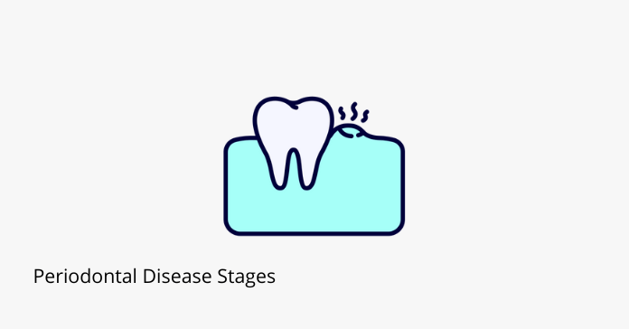 Stages of Periodontal Disease: How Does Gum Disease Progress? - Share ...