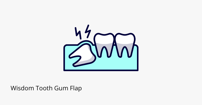 Gum Flap Over Wisdom Tooth: Causes & Treatment Options - Share Dental Care