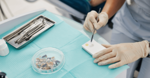 Glass Ionomer Filling: Benefits vs. Composite Dental Filling - Share ...