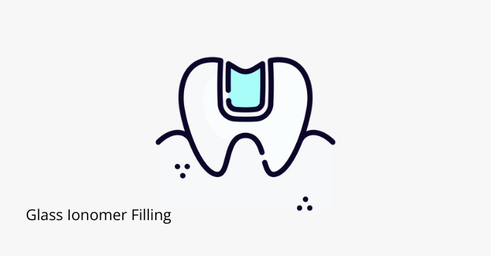 Glass Ionomer Filling: Benefits vs. Composite Dental Filling - Share ...