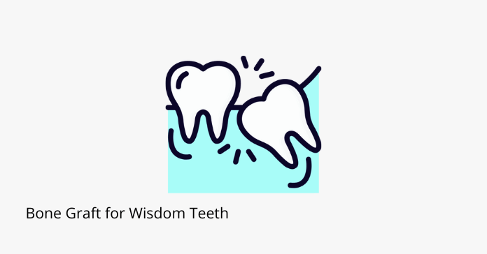 Bone Graft for Wisdom Teeth: When Is It Needed & What to Expect - Share ...