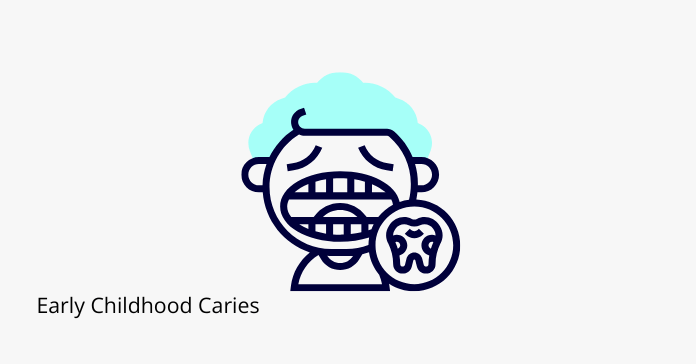 Early Childhood Caries: Signs, Causes, and What Parents Can Do - Share ...