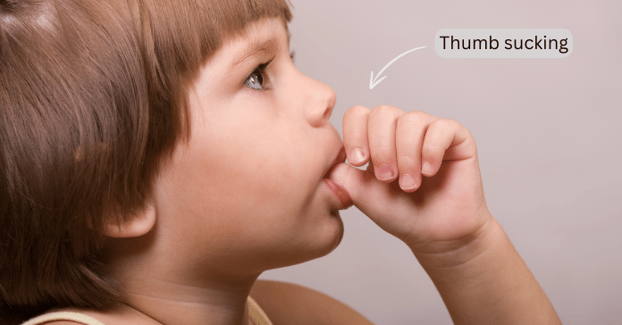 Open Bite: What Causes This Malocclusion and How to Fix It? - Share ...
