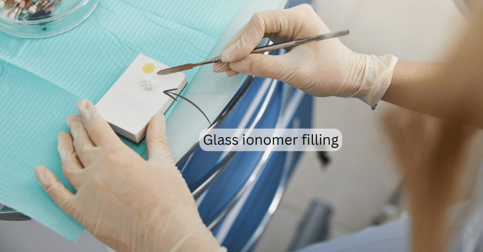 How Long Does a Cavity Filling Last? Lifespan and Care Tips - Share ...