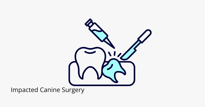 Impacted Canine Surgery: What to Expect and Aftercare Tips - Share ...