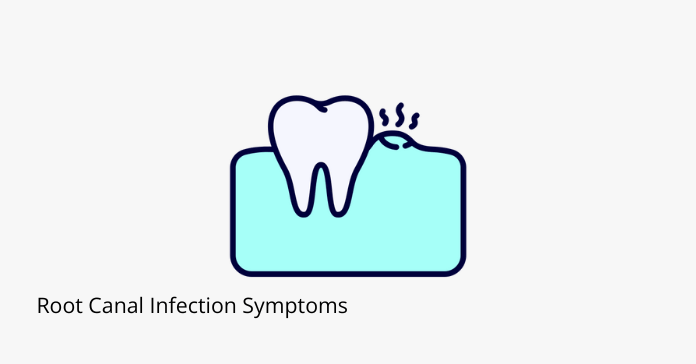 Root Canal Infection Symptoms: Signs of Infection to Look Out For ...