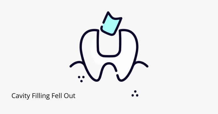 Cavity Filling Fell Out: Why Tooth Fillings Fall Out and What to Do ...