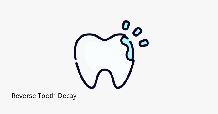 Reverse Tooth Decay: Can You Really Stop Early Cavities? - Share Dental ...