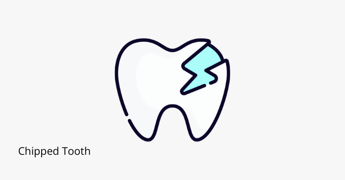 Chipped Tooth: How Dentists Fix a Chipped or Broken Tooth - Share ...