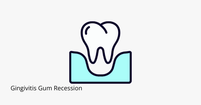 Gingivitis Gum Recession: Why Gums Recede and Treatment - Share Dental Care