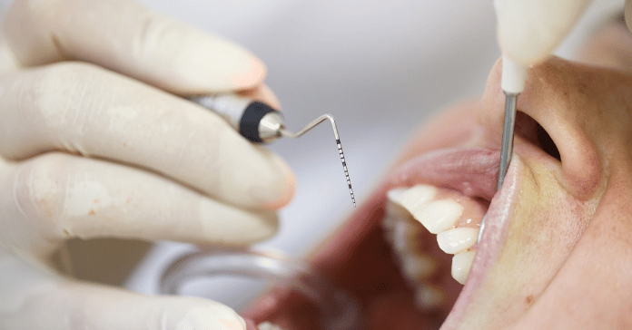 Gingivitis Gum Recession: Why Gums Recede and Treatment - Share Dental Care
