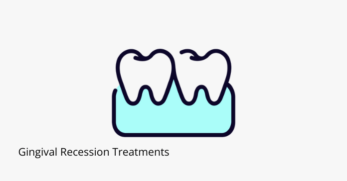 Gingival Recession Treatments: Options for Receding Gums - Share Dental ...