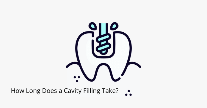 How Long Does a Cavity Filling Take? Dental Filling Timeline - Share ...