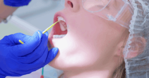 Tooth Decay Early: Signs of Early Cavities and How to Stop Them - Share ...