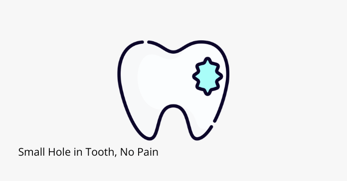 Small Hole in Tooth No Pain: Is It Still a Cavity? - Share Dental Care